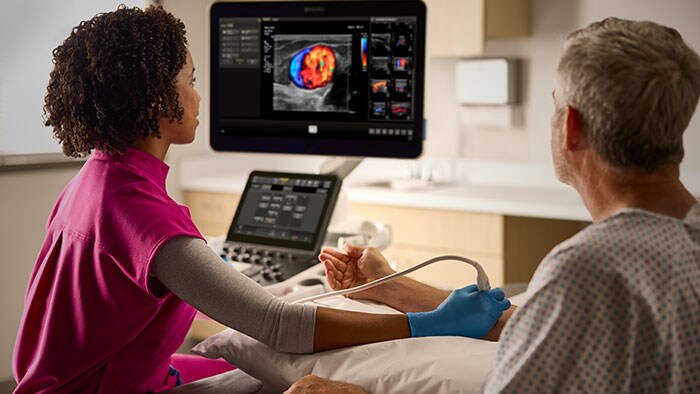 Flow Viewer – Products & Services – Philips