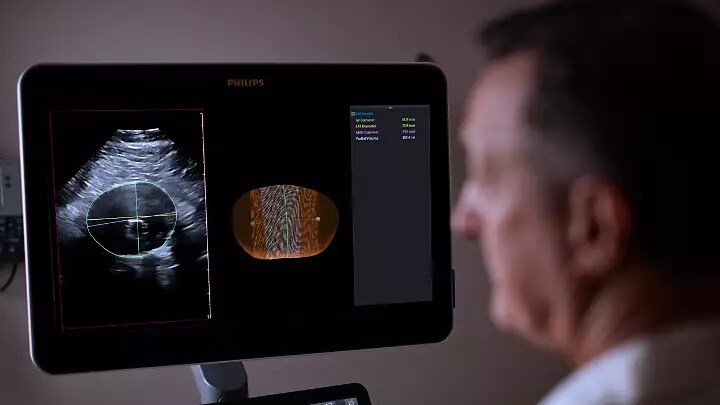 Improved diagnostic confidence, patient experience - Philips