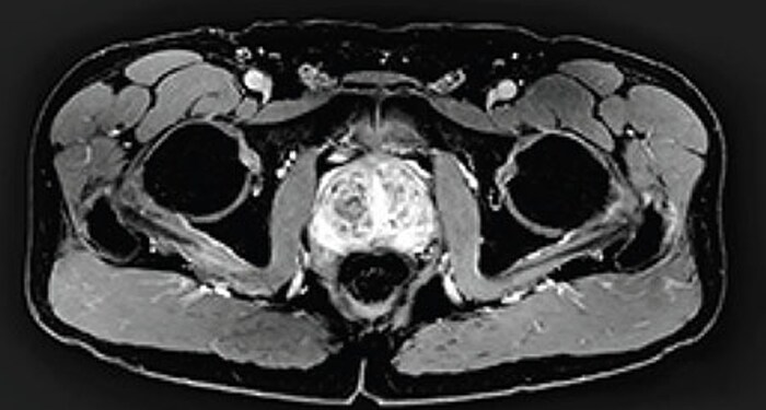 mDIXON XD | Philips Healthcare