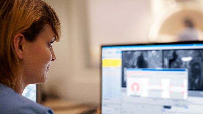 ScanWise Implant | Philips Healthcare