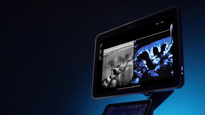 Microflow Imaging | Philips Healthcare