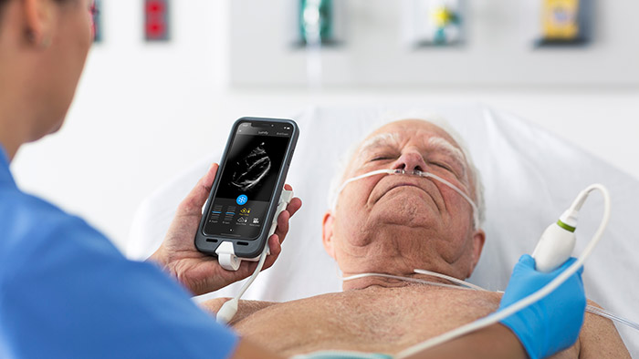 Point of Care Ultrasound for COVID-19 | Philips Healthcare