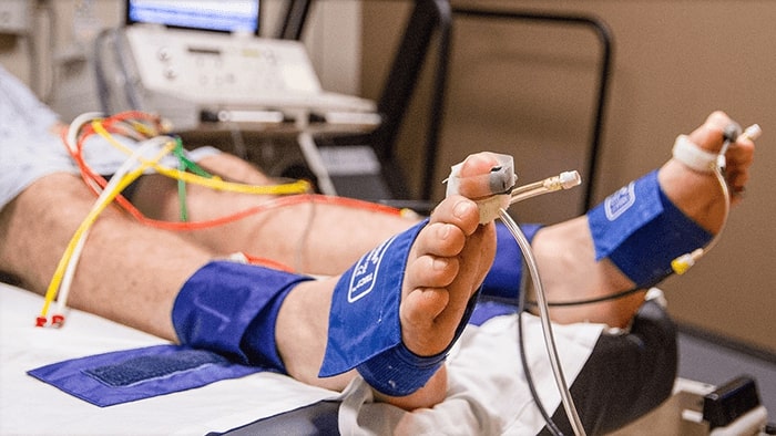 Peripheral Artery Disease (PAD) - Symptoms and Diagnosis | PVD and Me