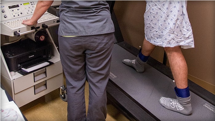 Critical Limb Ischemia (CLI) - Advance Stage of Peripheral Artery Disease
