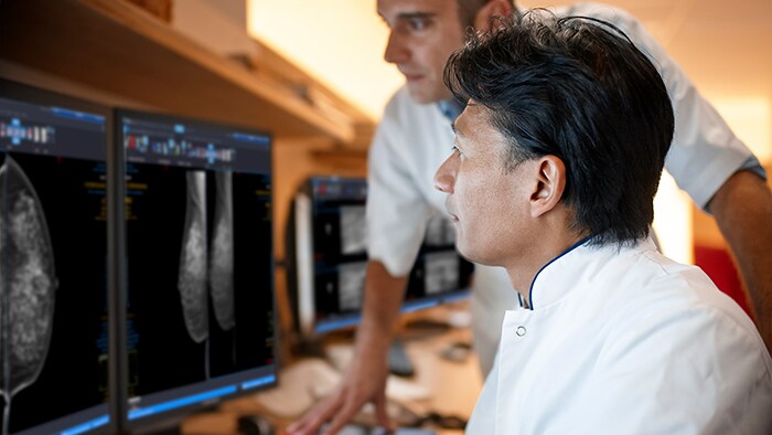 Scottish Breast Screening Programme - News | Philips