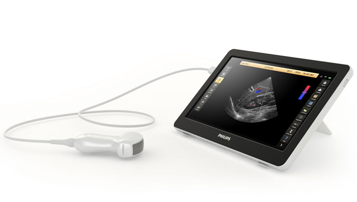 Philips launches breakthrough in point-of-care imaging technology ...