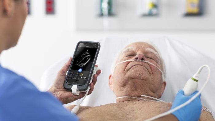 Beneficios de Lumify en cardiología: cuatro casos prácticos reflejan ...