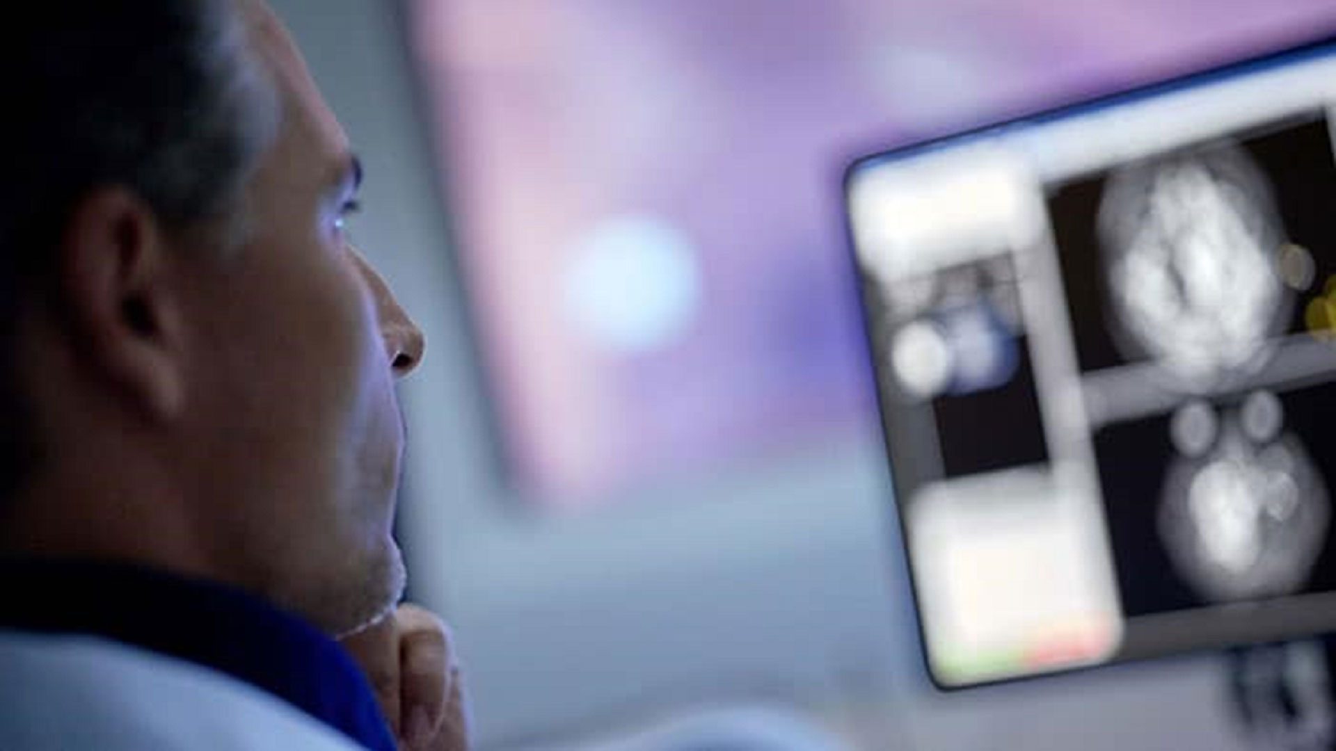 Philips expands ultrasound portfolio with EPIQ Elite - News | Philips