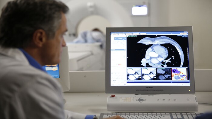 フィリップス、超高速スペクトラルCT検査を可能とする 「Spectral （スペクトラル）CT 7500」を発売開始 | フィリップス ヘルスケア