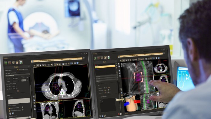 フィリップス、放射線治療計画装置「Pinnacle Evolution（ピナクル・エボリューション）」発売 | Philips Healthcare