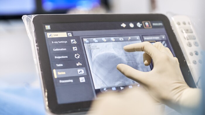 Philips helps Sydney Adventist Hospital to streamline their procedures ...