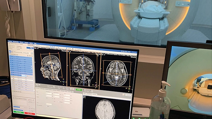 Hospital Clínico San Borja Arriarán adquiere resonador magnético con ...