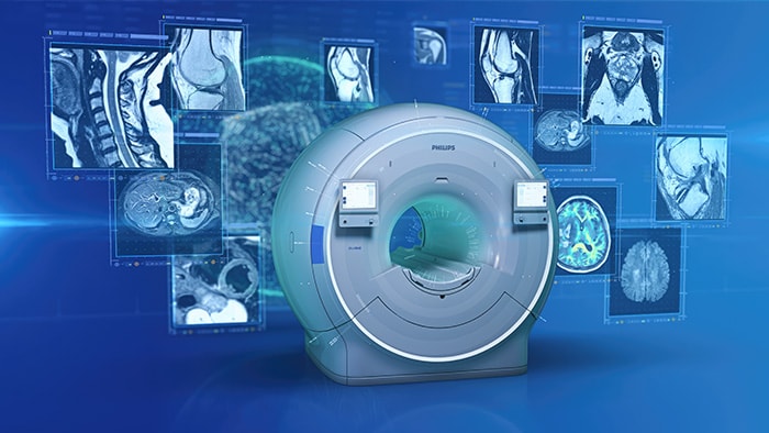 Philips HealthTech Spot: Episodio 4 – Calidad de imagen y velocidad a ...