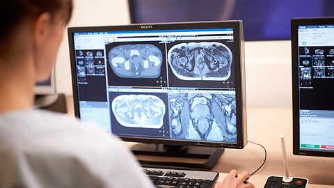 Philips introduces first commercial MR-only solution for prostate ...