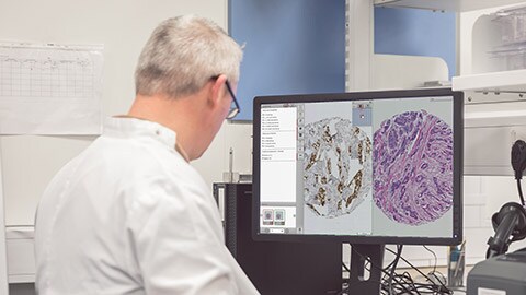 Philips speeds up research and biomarker discovery with major upgrade ...