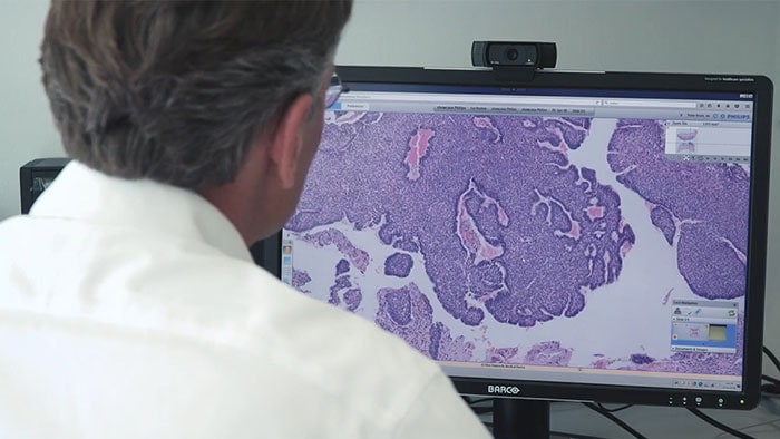New deployment of Philips digital pathology - News | Philips