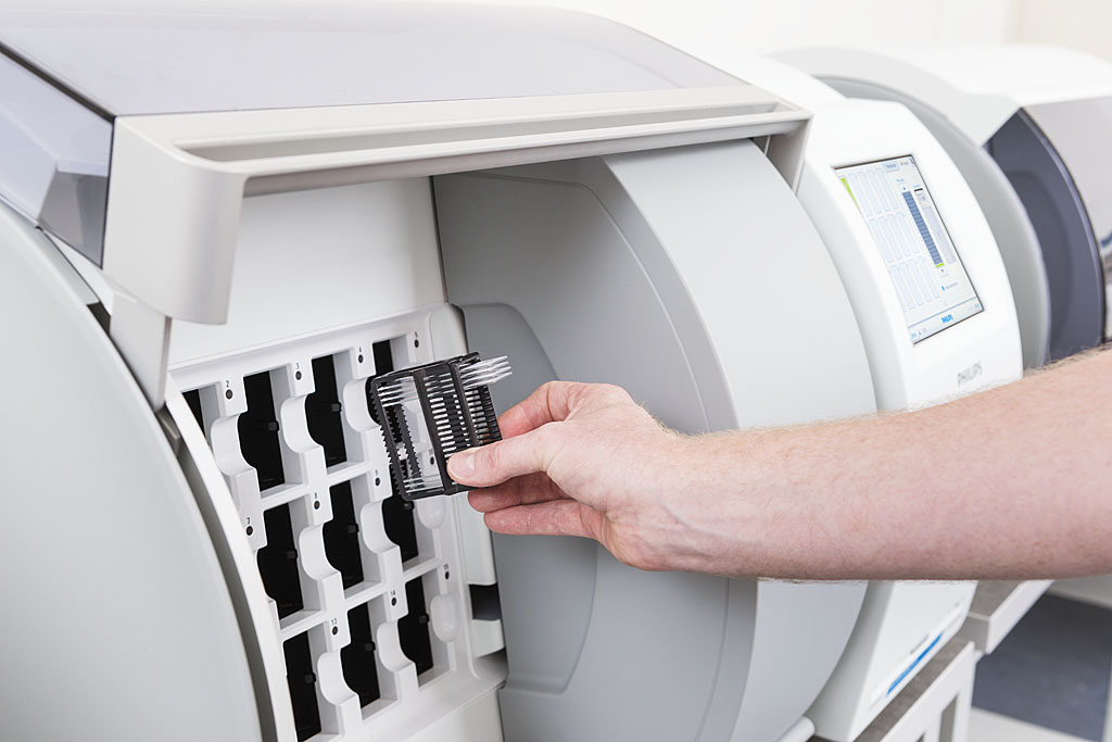 Philips agreement with Oxford University Hospitals - News | Philips