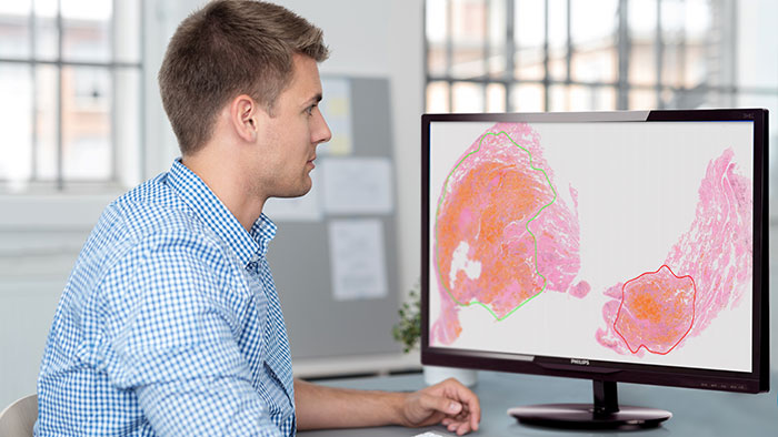 Philips shows digital pathology & imaging analytics