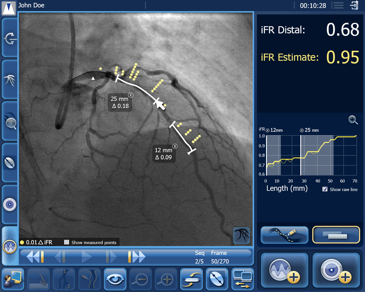 Philips integrated portfolio for cardiac care at ACC19 - News | Philips