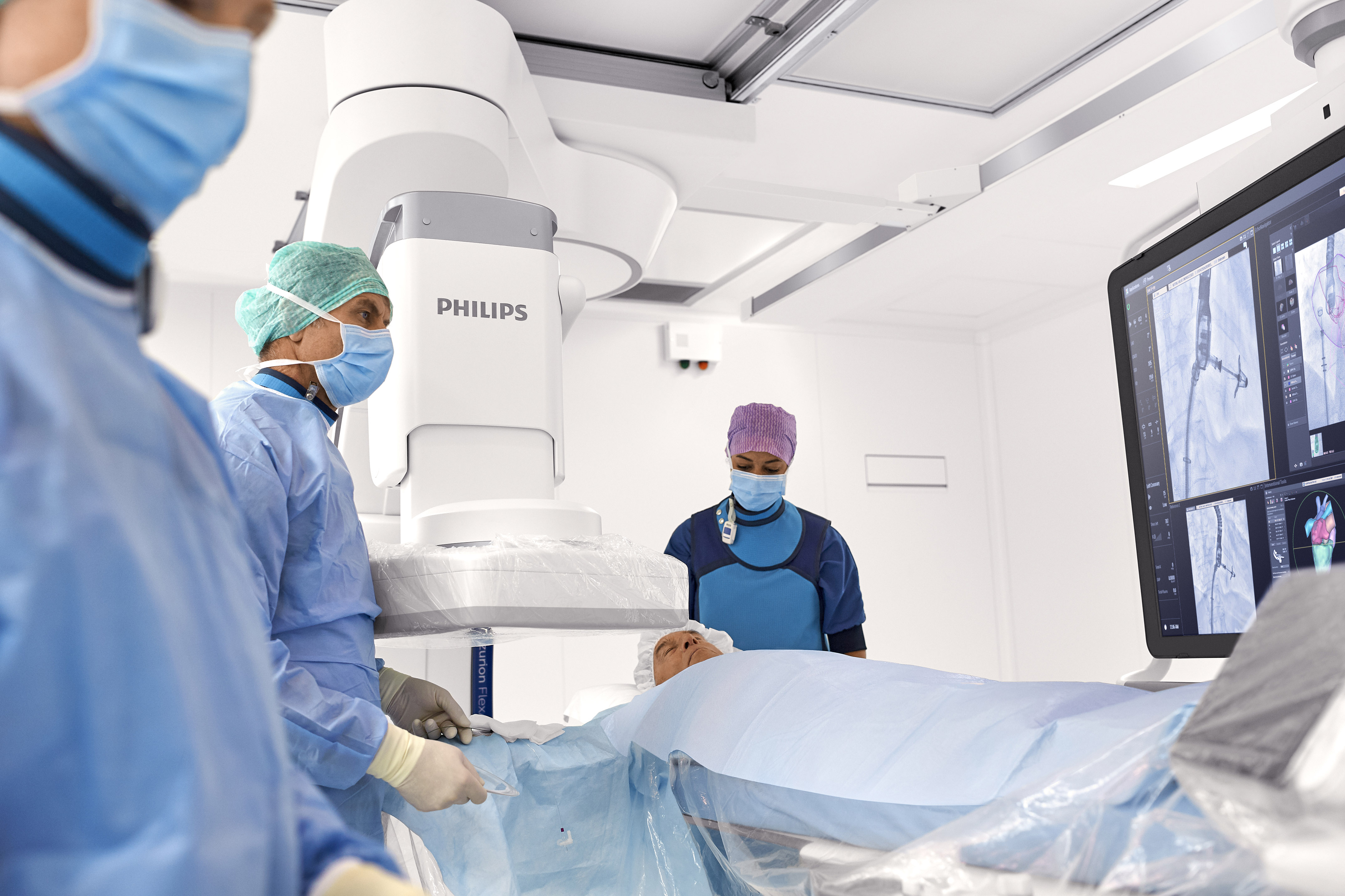 Philips Azurion with FlexArm for image-guided procedures - News | Philips