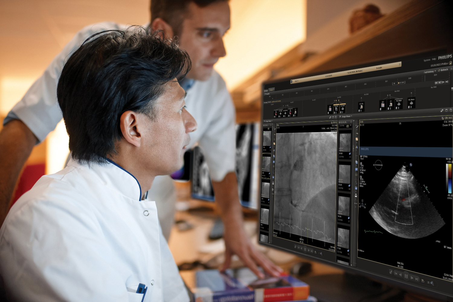 Philips debuts innovations in ultrasound and enterprise informatics at ESC 2019 - News | Philips