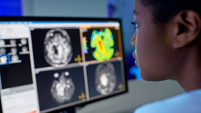 Philips highlights growing role of AI in MR - News | Philips