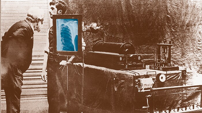 First X Ray Image
