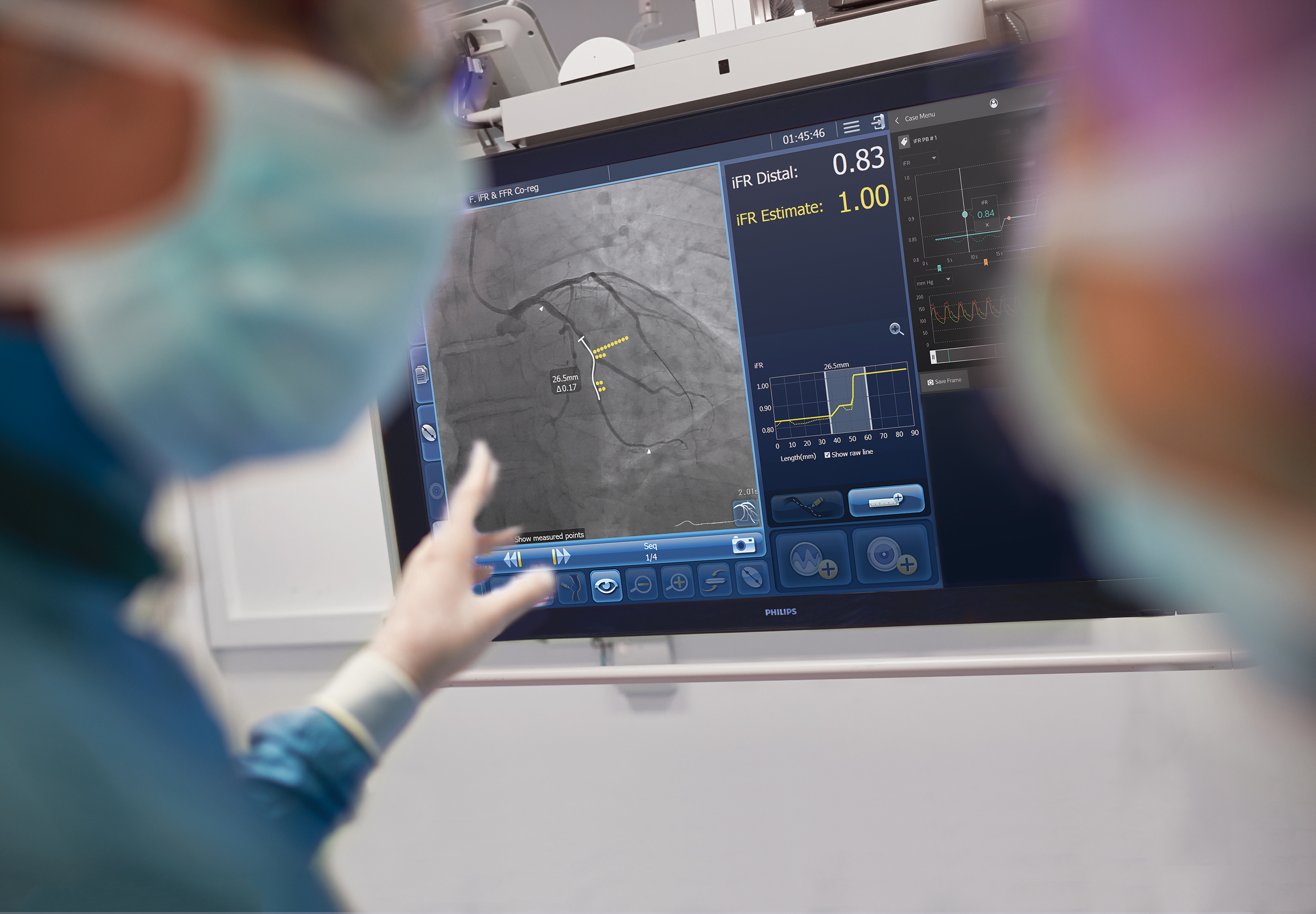 Philips announces DEFINE GPS global multicenter study - News | Philips