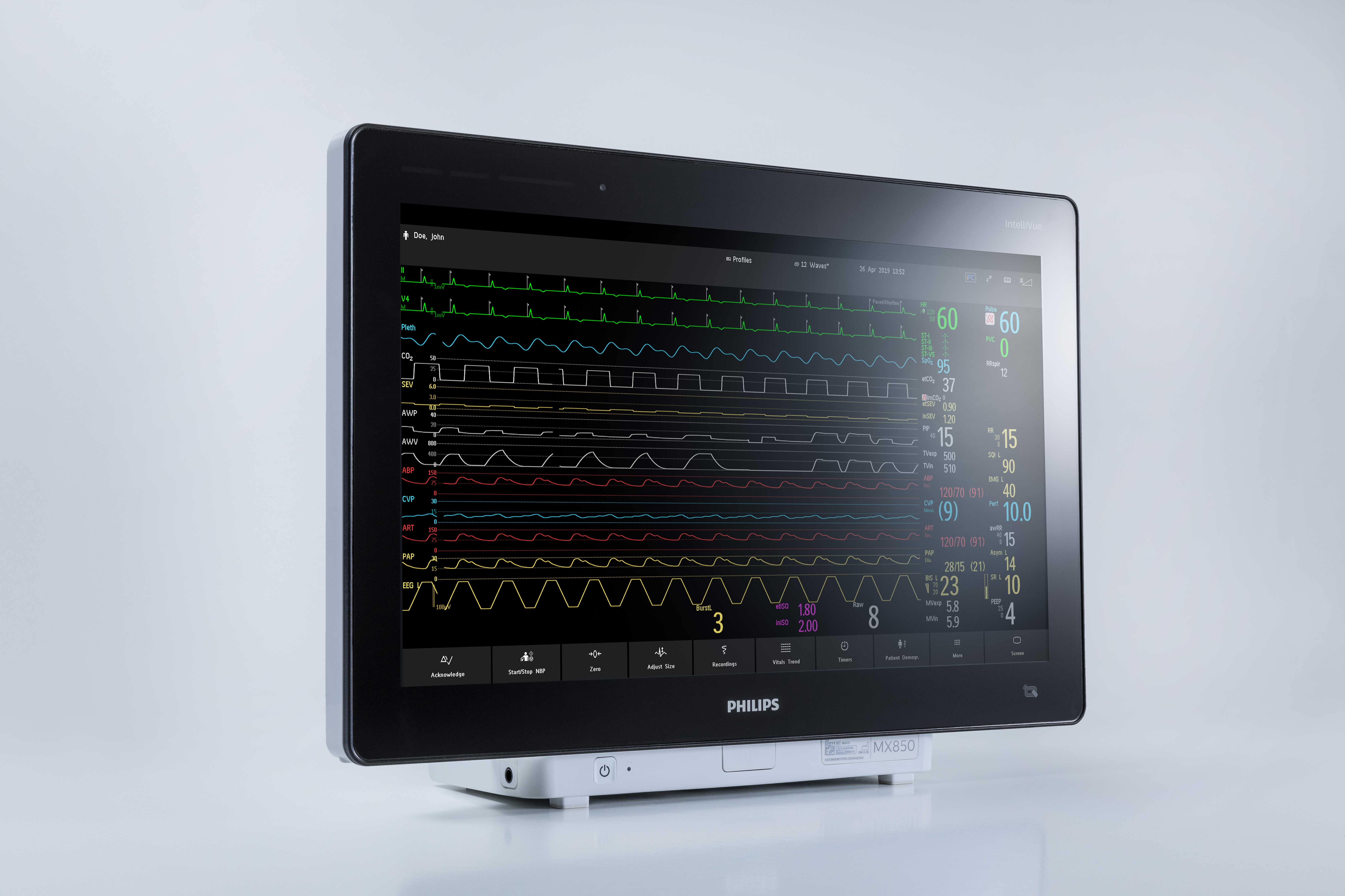 FDA Issues EUA for Philips Acute Care Monitors - News | Philips