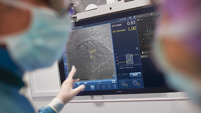 New real-time 3D intracardiac echocardiography catheter - News | Philips