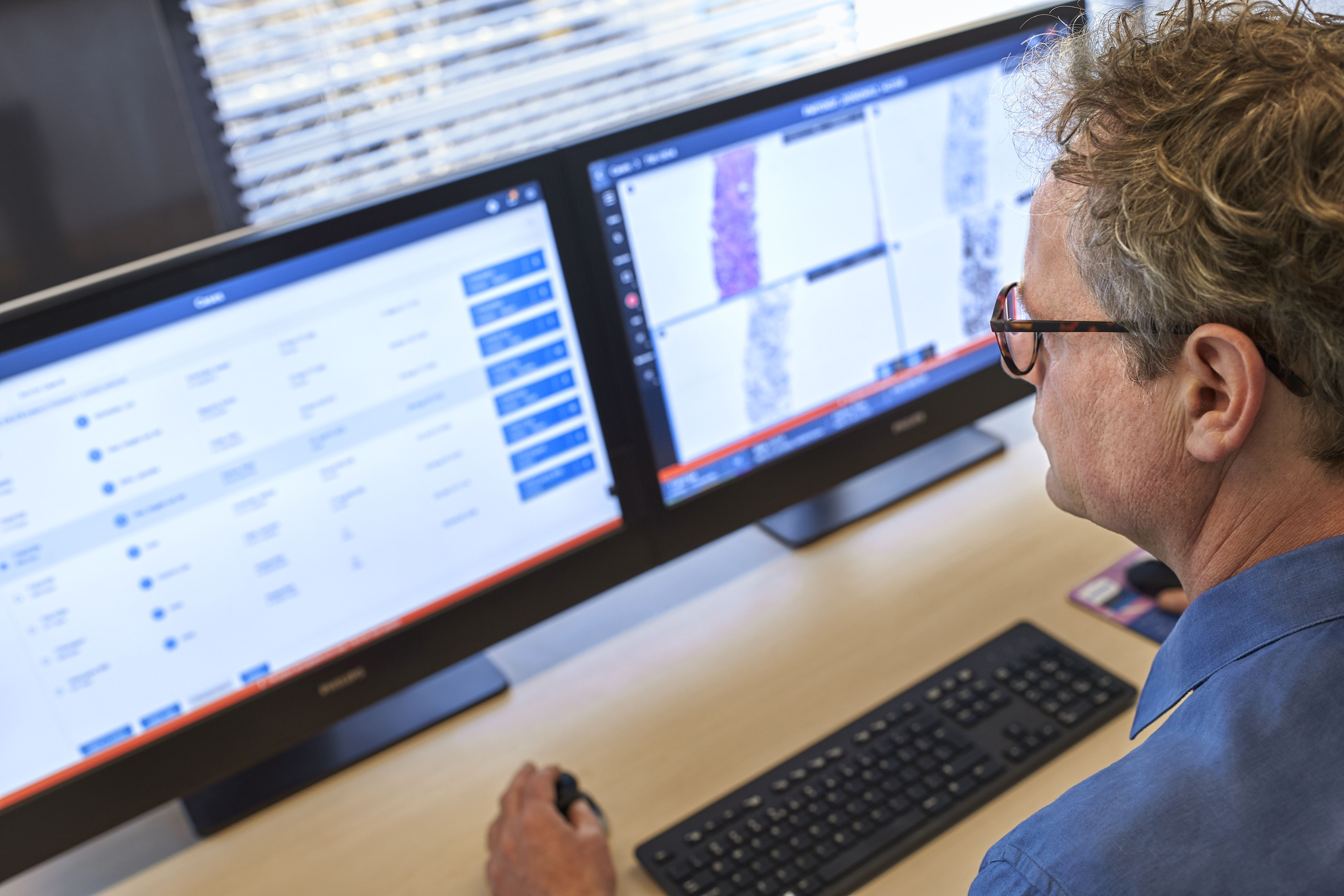 Philips Digital Pathology Suite - News | Philips