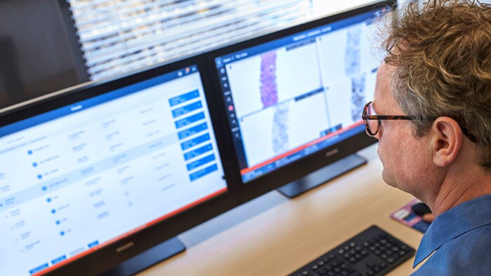 Philips nouveau scanner de pathologie numerique