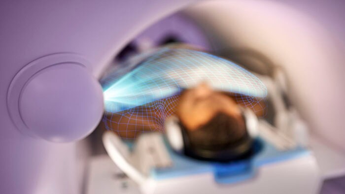 How AI can enhance the human experience in healthcare | Philips