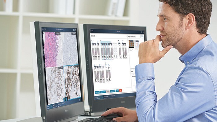 Philips, Ibex partner on digital pathology - News | Philips