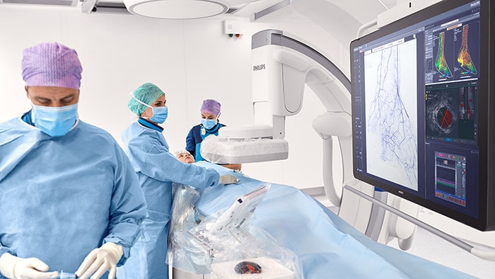 Largest-ever real-world patient analysis of IVUS - News | Philips