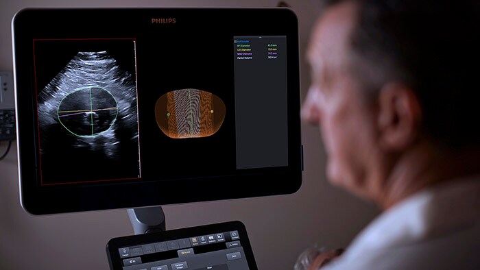 Philips integra ultrassom 3D com software inovador para avanço na ...