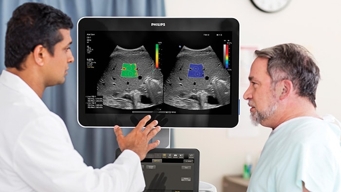 Nieuwe innovaties voor echografie - Nieuws | Philips