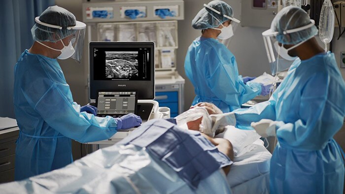 Philips Compact Ultrasound system receives FDA 510(k) - News | Philips
