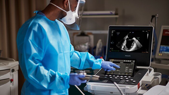 Philips Compact Ultrasound 5500CV - News | Philips