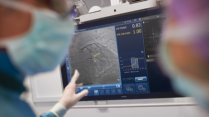 Largest ever Philips iFR data analysis - News | Philips