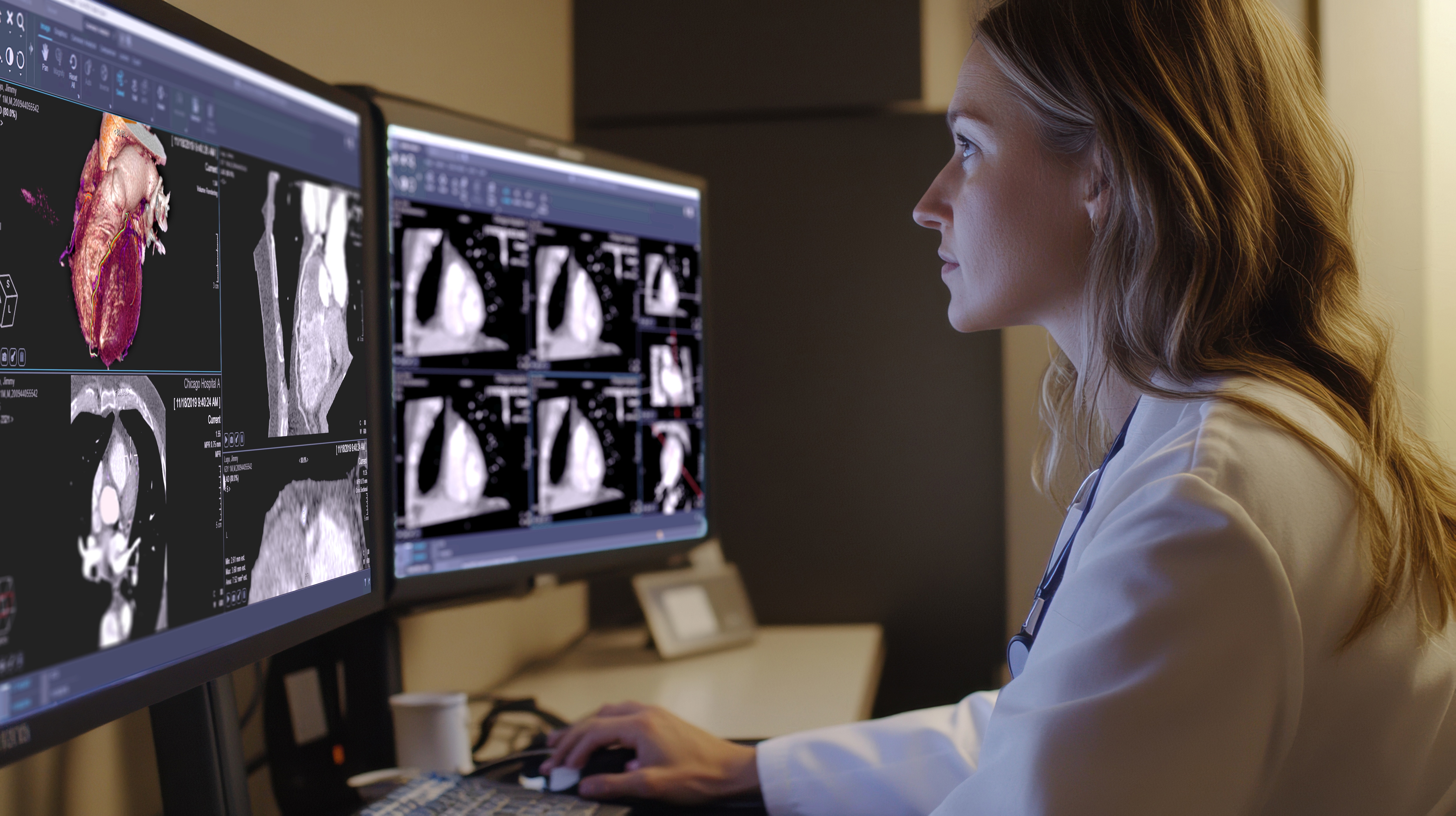 Philips introduces web-based diagnostic viewer | Philips