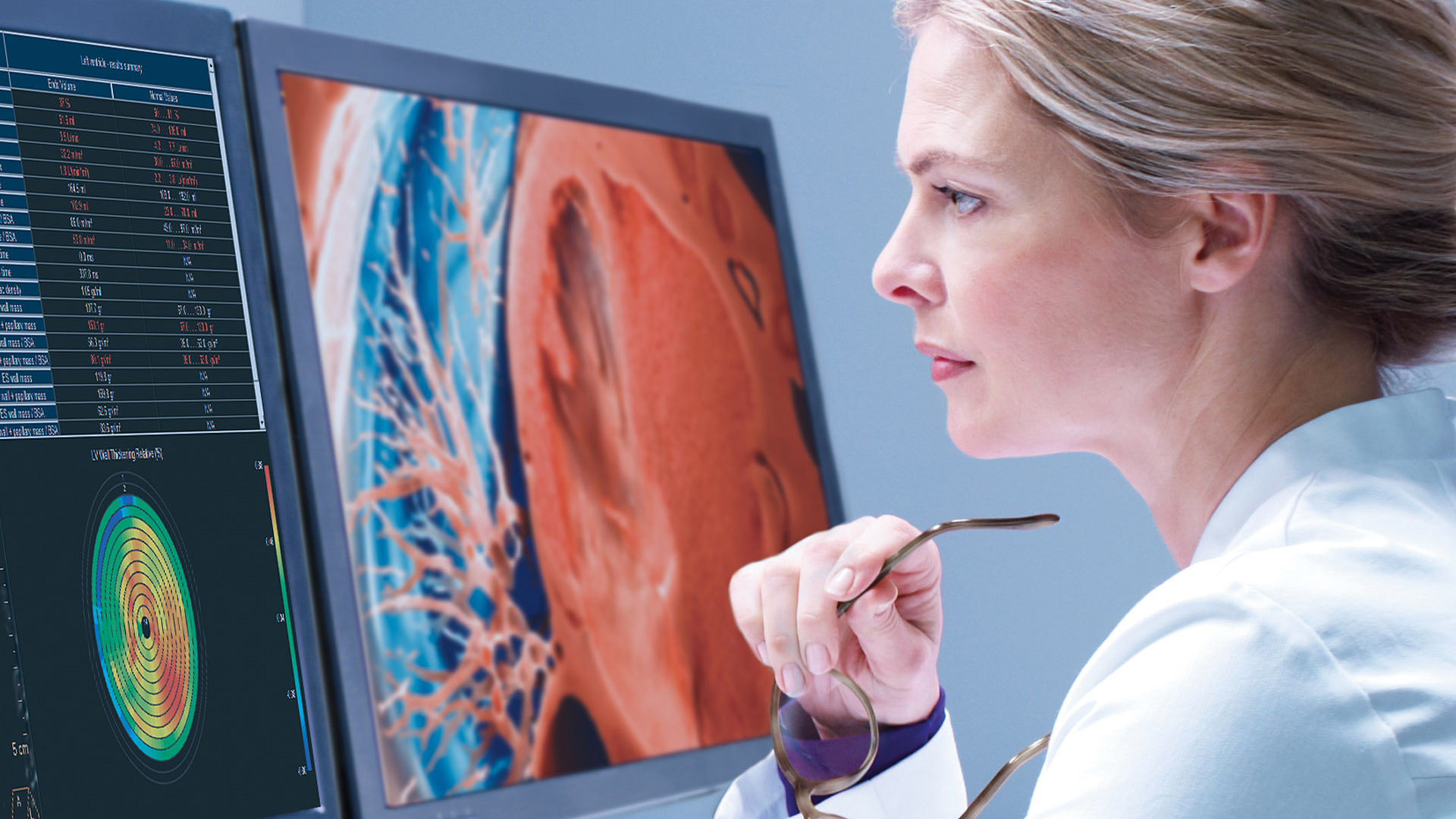 Philips #1 ranked medtech company among Clarivate Top 100 Global ...