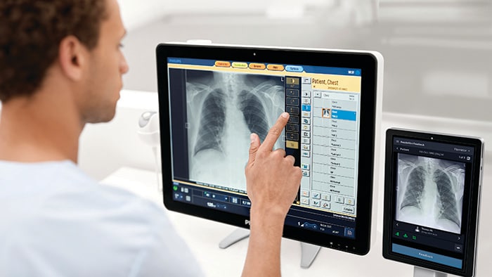 Philips lanceert Radiology Smart Assistant met AI - Nieuws | Philips