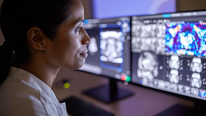 BNR Beter: 7 Tesla MRI scanner door Amsterdam UMC ingezet voor ...