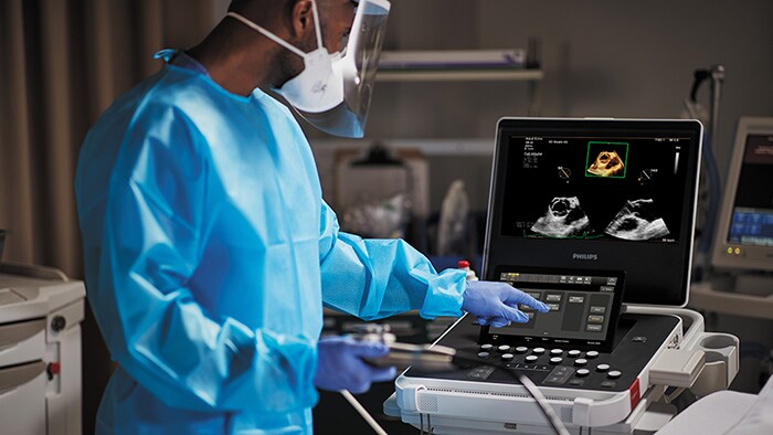 Philips presenteert Compact Ultrasound 5500CV met AI verbeterde ...