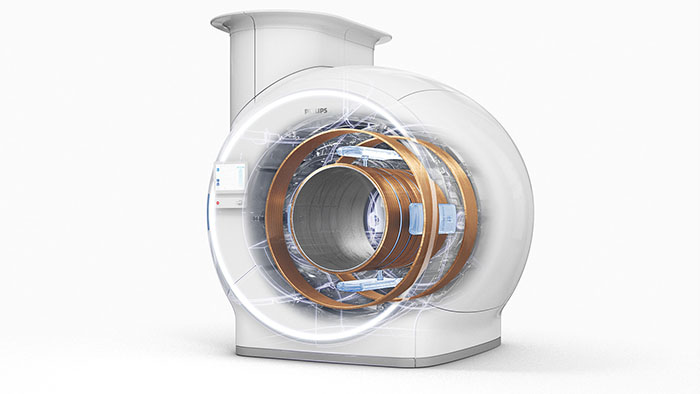 OLVG neemt Philips MRI scanner met AI in gebruik | Philips