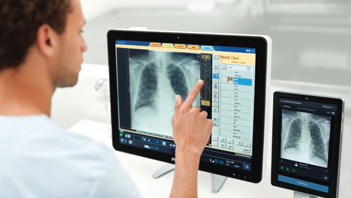 Philips debuts AI-powered Radiology Smart Assistant in Nordics to ...
