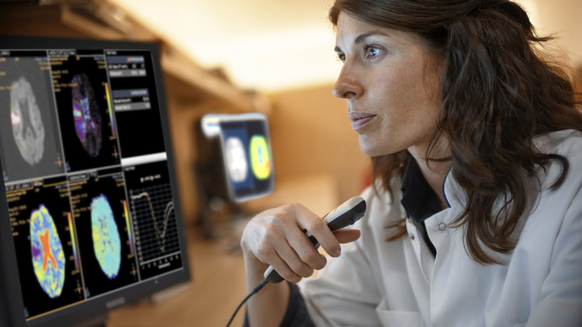 Philips and Unilabs sign agreement for Advanced Visualization system ...