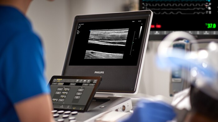 Philips’ intelligent end-to-end ultrasound innovations take center ...