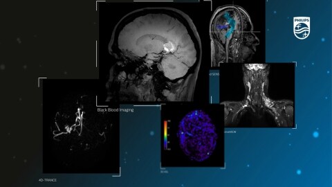 Philips to unveil suite of advanced MR-based software applications for ...